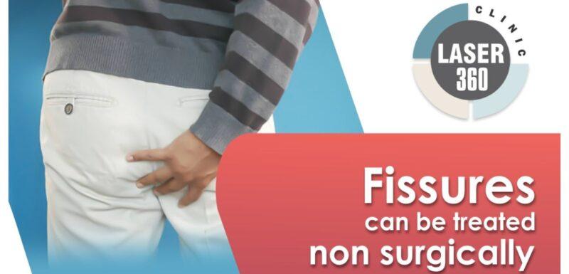 Find Out Some Important Details on Fissure Surgery – Laser360clinic.com