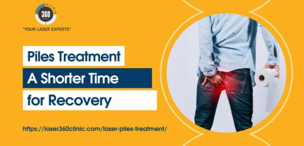 Laser Piles Treatment: A Shorter Time for Recovery – Laser360clinic.com
