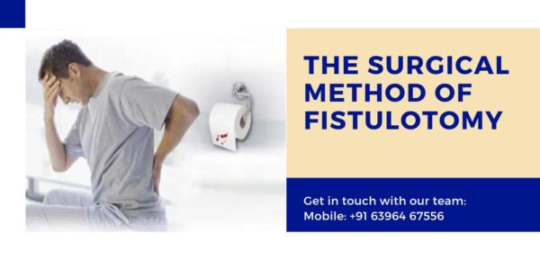 What Risks are Possible with Fistulotomy Surgery? – Laser360clinic.com
