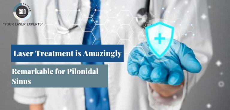 Laser Treatment is Amazingly Remarkable for Pilonidal Sinus ...